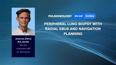 Peripheral Lung Biopsy With Radial Ebus And Navigation Planning Pulmonology On Air