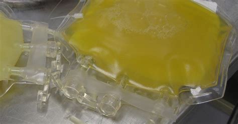 Takeda Contracts Resilience To Bolster Plasma Supply Bioprocess Insider