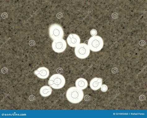 Cryptococcus In Peripheral Blood Smear Gram Stain Royalty Free Stock