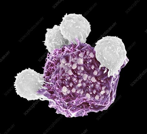 T Lymphocytes And Cancer Cell Sem Stock Image C0500610 Science