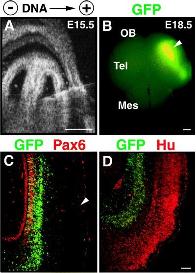 Expression Of The Exogenous Gene After In Utero Ep Download Scientific Diagram