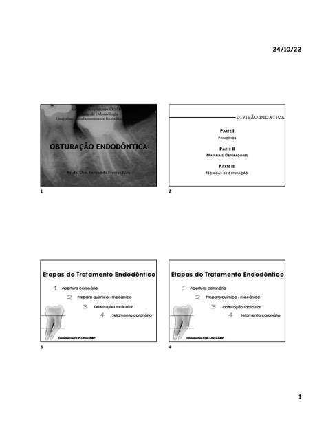 Fundamentos Da Obturação Endodôntica Princípios Materiais E Técnicas