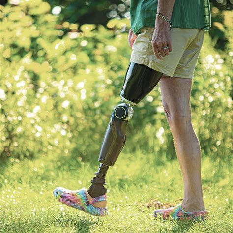 What Are The Parts Of A Prosthetic Leg Össur Prosthetics