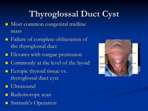 Ppt Head And Neck Masses Including Salivary Glands Powerpoint