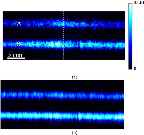Elevational Synthetic Aperture Focusing For Three Dimensional