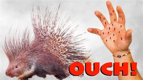 Porcupine Quills In Human
