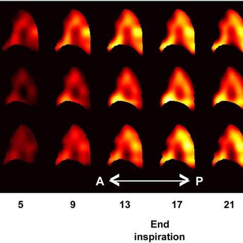 Back Extrapolation Method Of Determining A Reasonable Starting Point