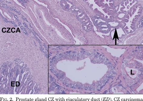 Normal Prostate Gland Histology