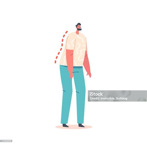 남성 캐릭터가 구부러진 척추와 머리 기울기로 서있는 위치가 잘못되었습니다 허리 건강을위한 나쁜 자세 척추 곡률 굽은에 대한 스톡