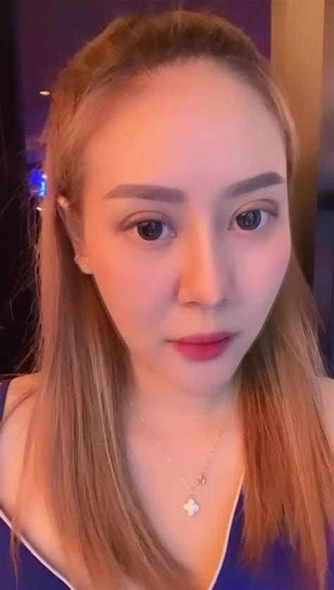 📸 รีวิวตาสองชั้น หลังทำ10 วันเท่านั้น 📷 👀👁โปรโมชั่นตาสองชั้น สวยปังๆ โดยทีมแพทย์ผู้เชี่ยวชาญ👁👀