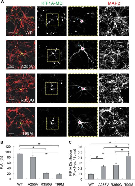 Functional Impact Of Kif1a Motor Domain Recessive Missense Mutations Download Scientific