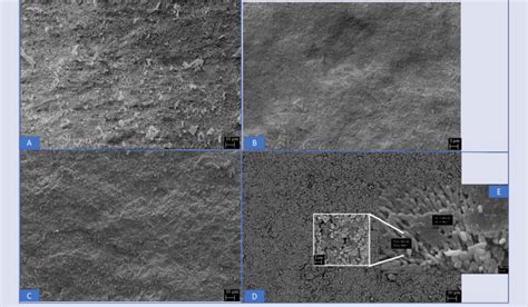 SEM Of H N HAPs Size Measurement At 200nm For A H N HAP B Download Scientific Diagram
