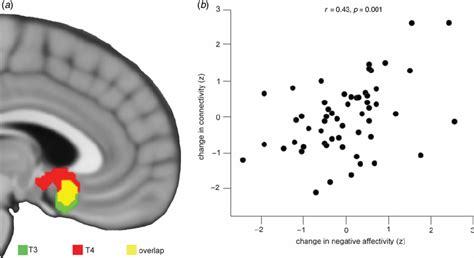 The Relationship Between Amygdala Subgenual Anterior Cingulate Cortex Download Scientific
