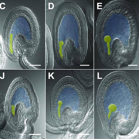 Pdf Fertilization Independent Seed Polycomb Repressive Complex 2