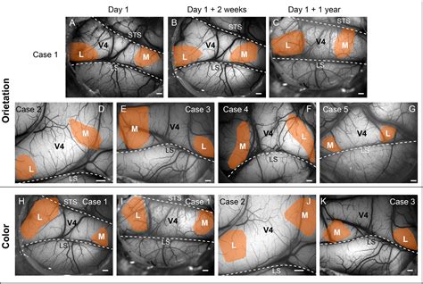Figures And Data In Spatial Frequency Representation In V2 And V4 Of