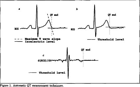 Figure 1 From Accuracy Of Automatic Qt Measurement Techniques