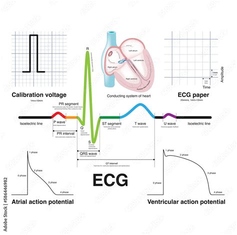 Atrial Depolarization Forms A P Wave Ventricular Depolarization Forms A Qrs Wave And
