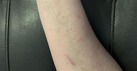 So Sick Of Allergies Screaming Into The Void Feel Free To Ignore