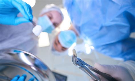 Dental Code For Suture Removal Dental Suture Manufacturer