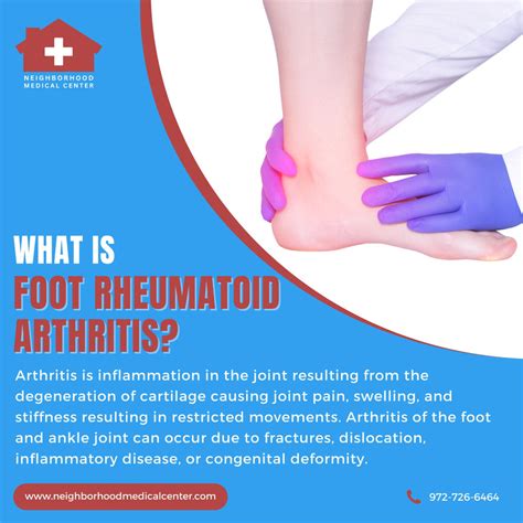What Is Foot Rheumatoid Arthritis Dallas Texas Neighborhood Medical Center