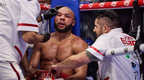 Chris Eubank Sr Reveals Seriousness Of Son Eubank Jrs Condition After Conor Benn Battle Dazn