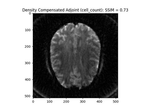 GPU Density Compensation Reconstruction Comparison Pysap V