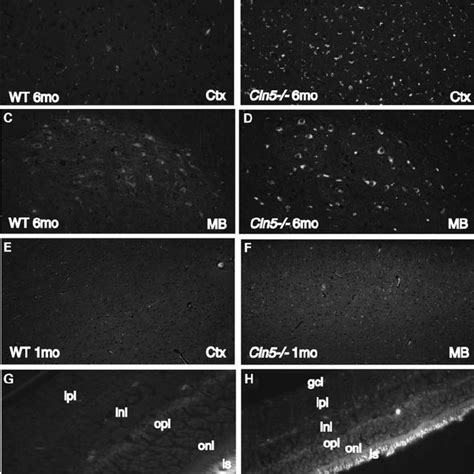 Interneuron Staining In The Brains Of 6 Month Old Mice Immunostaining
