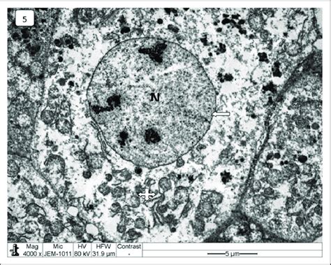 Transmission Electron Micrograph Of Ultrathin Section In Hepatocyte Download Scientific Diagram