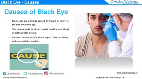 Ppt Black Eye Causes And Treatment Powerpoint Presentation Free