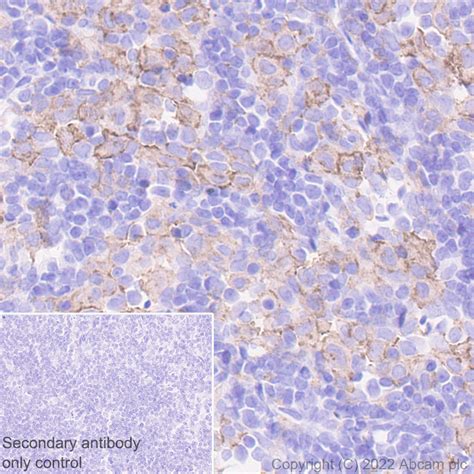 Antigen Retrieval 100x Tris Edta Buffer Ph 90 125 250 Ml Ab93684