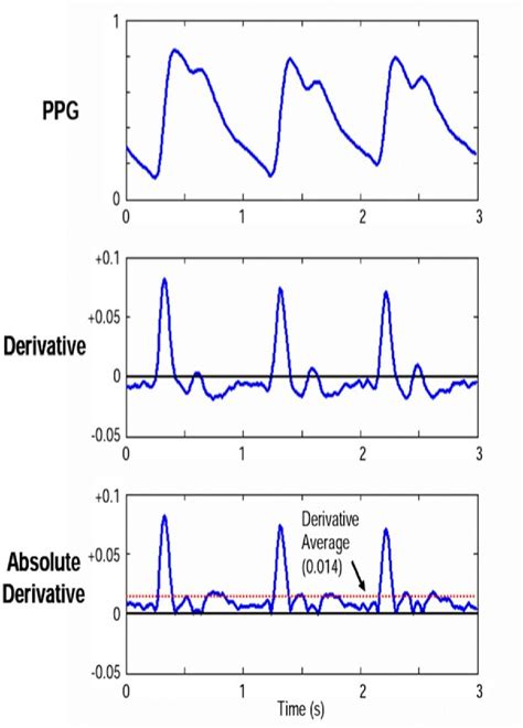 Figure 61 From Development Of Multi Modal System For Extraction Of Spo2 From