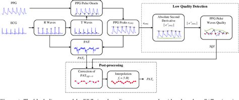 Table 1 From Influence Of Photoplethysmogram Signal Quality On Pulse