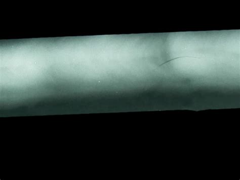 Xray Object Detection Dataset By Ridham