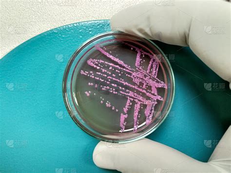 志贺沙门菌 Ss 琼脂培养基的培养及敏感性试验。显示大肠杆菌的生长，认为是正常菌群。