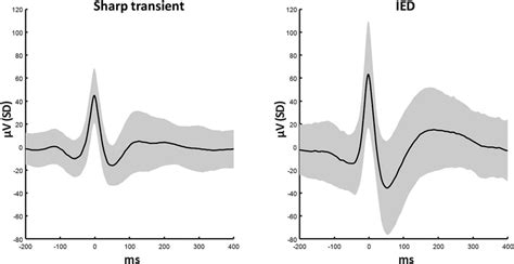 Morphologic Averages Of Sharp Transients And Focal Ieds In Standard Download Scientific Diagram