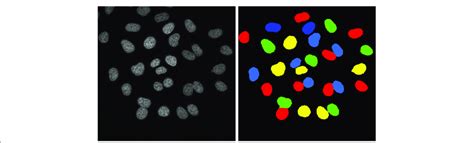 Microscopy Image And Final Segmentation Result Original Widefield Download Scientific Diagram