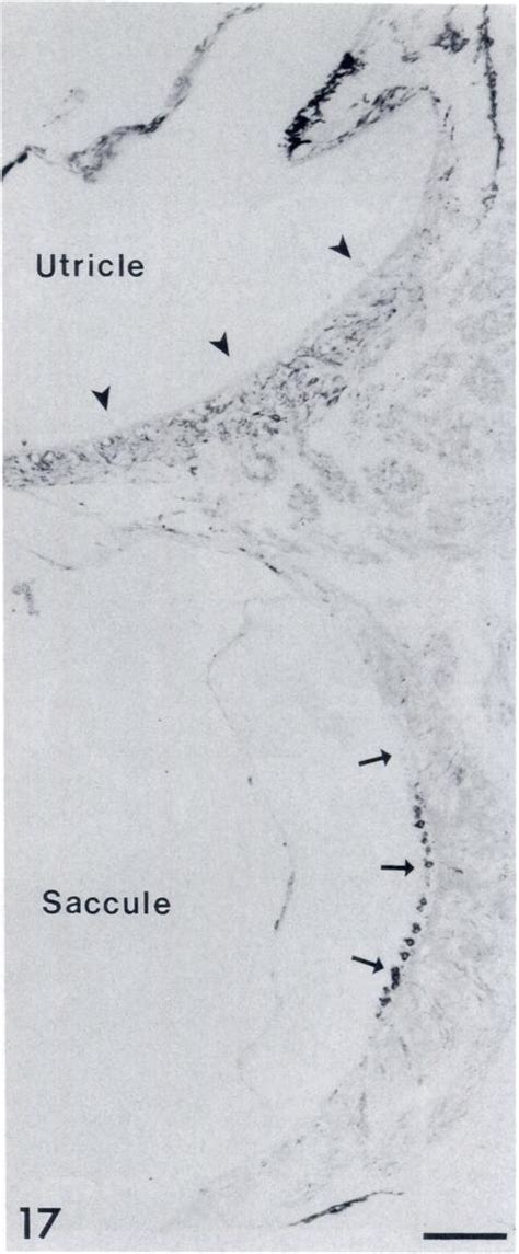 The Variable Content Ofvimentin Type If In The Outer Sulcus Epithelial