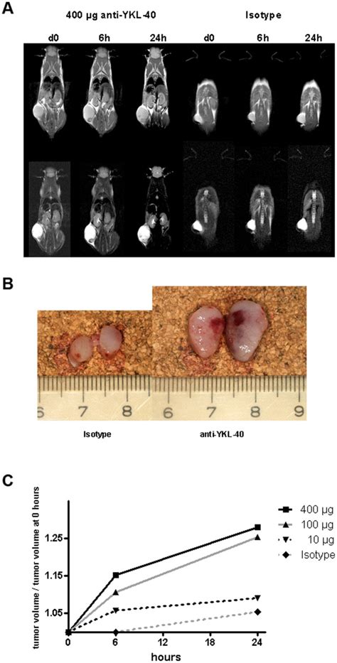Bleeding Can Be Seen As Dark Shades In The Tumor A Two Dissected