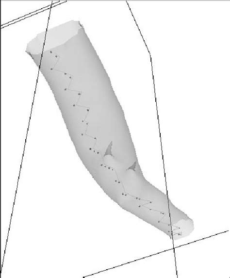 Centerline Detection For Simple Non Bifurcating Tubular Structure