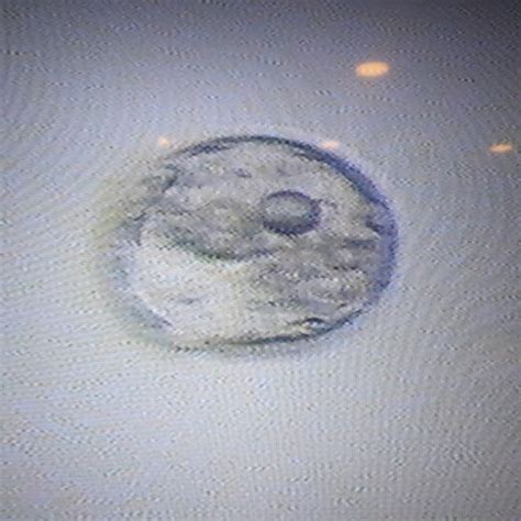 동결2차도 착상실패로 반착검사 받음