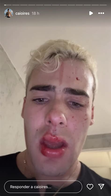 Caio Cerqueira E Luan Alencar Entenda O Que Aconteceu Por Causa De