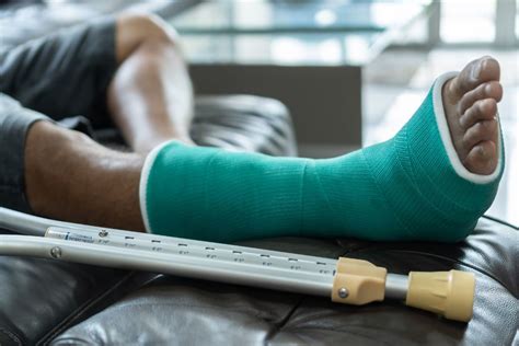 Fracture Vs Break Is There A Difference Motion Orthopaedics