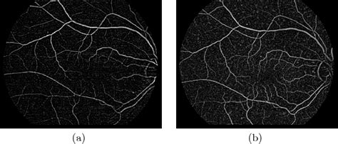 Figure 2 From Multimodal Registration Of Retinal Images Using Domain Specific Landmarks And