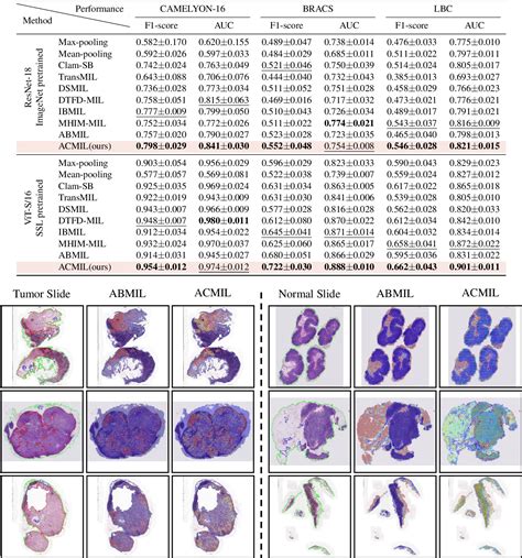 Table 1 From Attention Challenging Multiple Instance Learning For Whole Slide Image