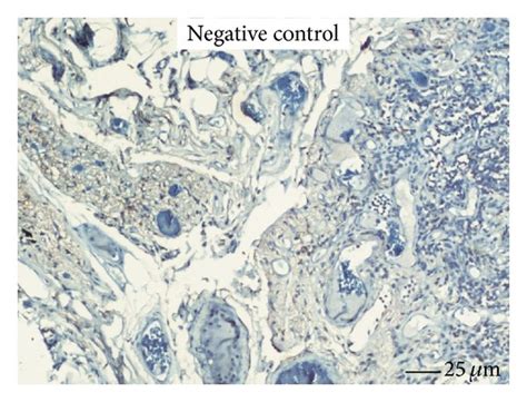 Representative Tissue Microarray Section Immunostained With Monoclonal