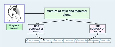 Electrocardiogram Ecg Mixture Acquisition Of Fetal Fecg And Download Scientific Diagram