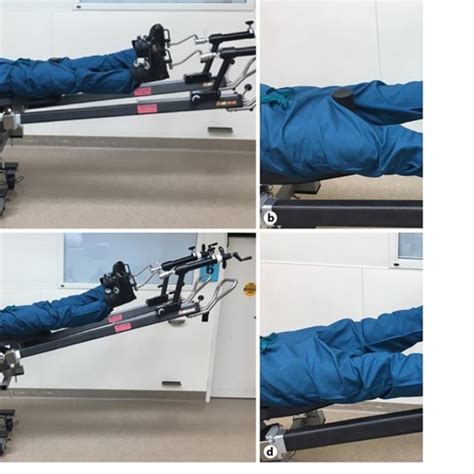 A D The Positioning Of The Patient During The Hip Arthroscopic
