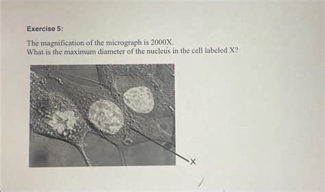 Solved Exercise The Magnification Of The Micrograph Is Chegg