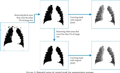Figure 3 From Lung X Ray Image Segmentation Using Heuristic Red Fox