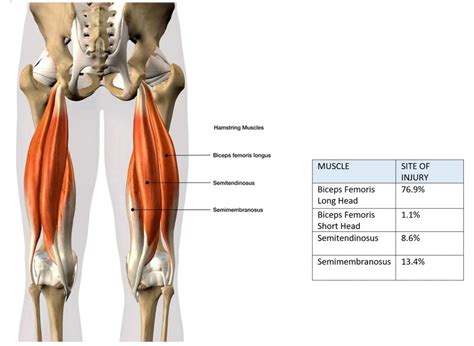 What Is A Hamstring Strain Sportsfit Physio And Health